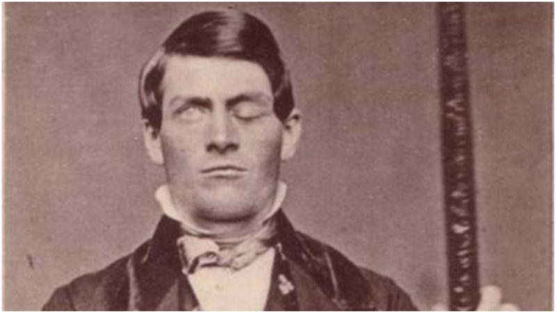 The bizarre story of how a railroad worker survived an iron rod which ...