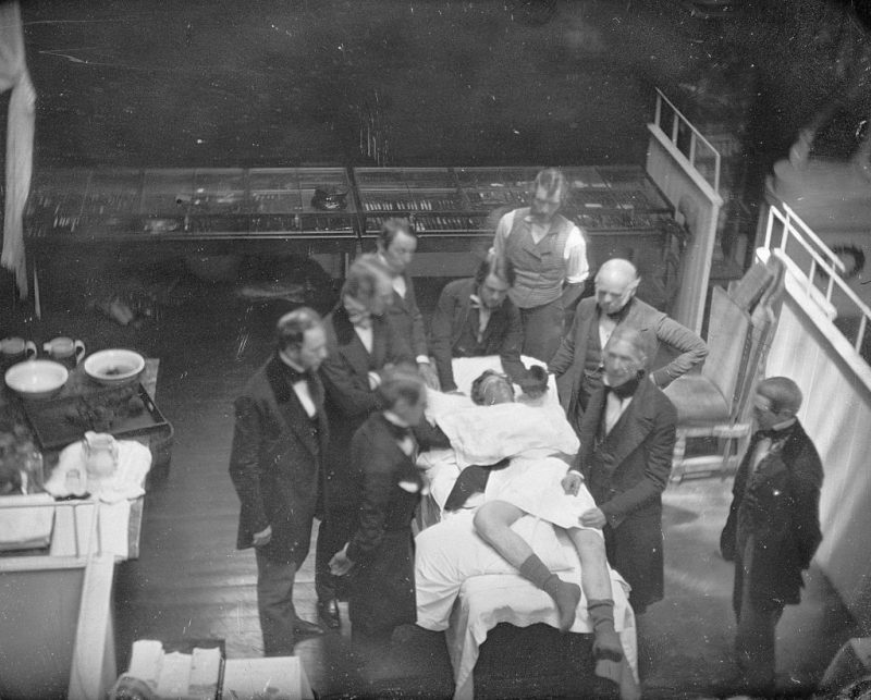 The Horrors of Battlefield Surgery During the Civil War | The Vintage News