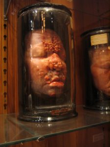 8 Creepy Museums in America | The Vintage News