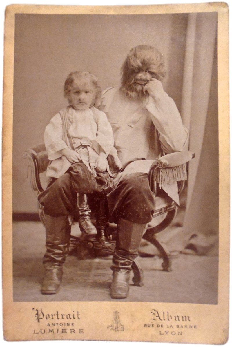 The Russian "Dog-Faced Boy" who Became a Global Sensation | The Vintage ...
