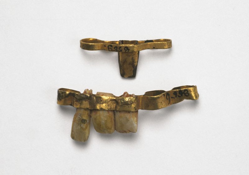 Terrifying Ancient Dental Practices | The Vintage News