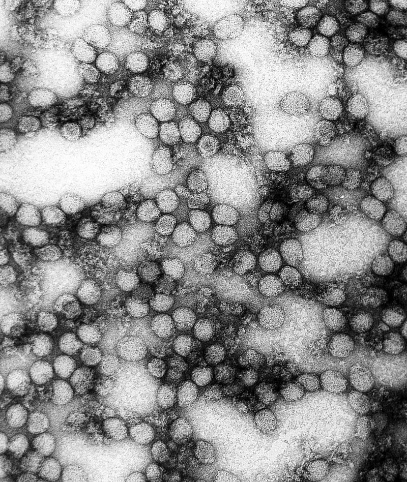 To Find a Cure for Yellow Fever One Brave Nurse Sacrificed her Life to ...