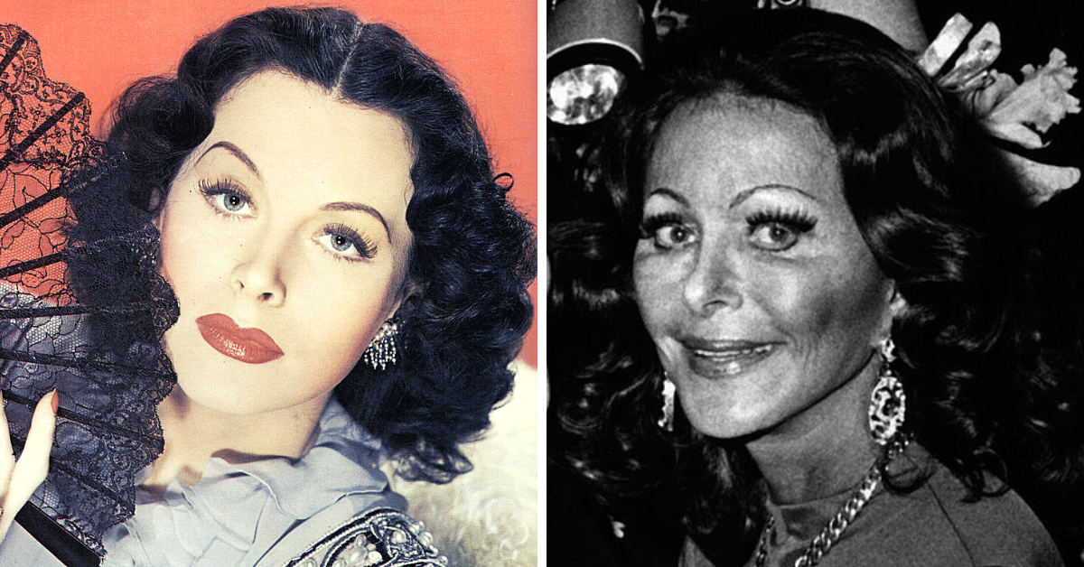 Before and After: 10 Classic Hollywood Stars Who Underwent Plastic ...