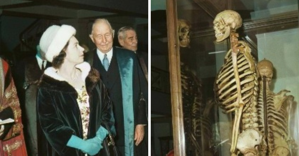 London Museum Finally Honors Last Wishes of the 'Irish Giant' | The ...